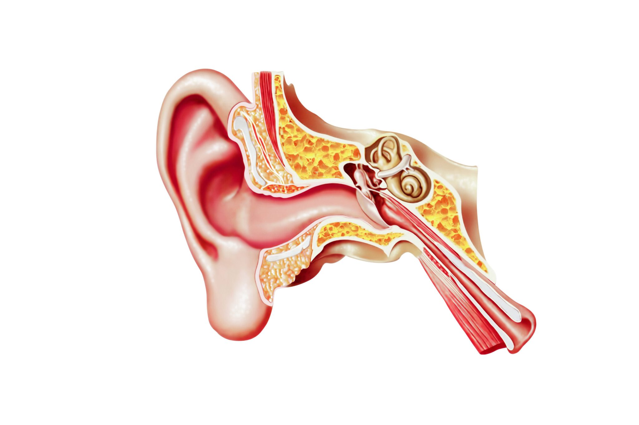 IVRT® - Cholesteatom: Symptome, Diagnose & Behandlung
