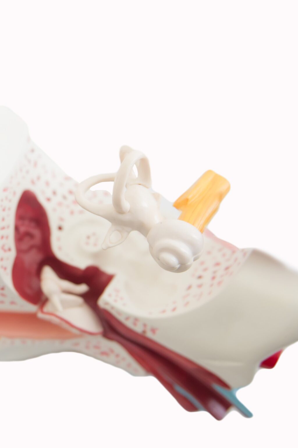 IVRT - Instituut voor vestibulaire revalidatie - Vertigo en ...